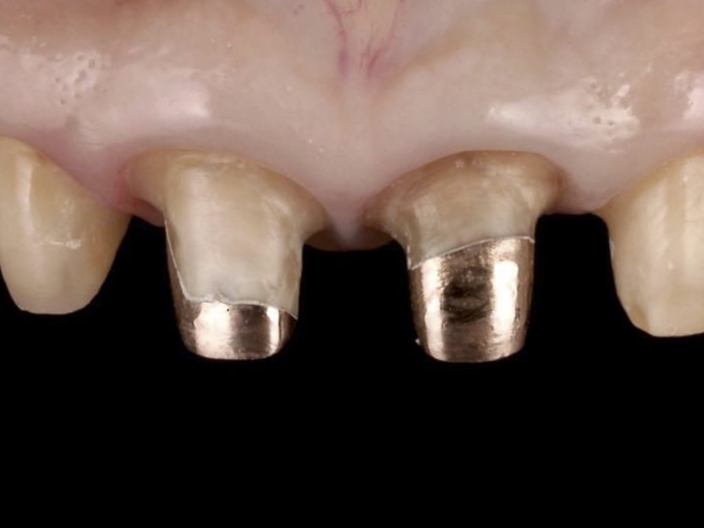 Home Oral view - Oral view